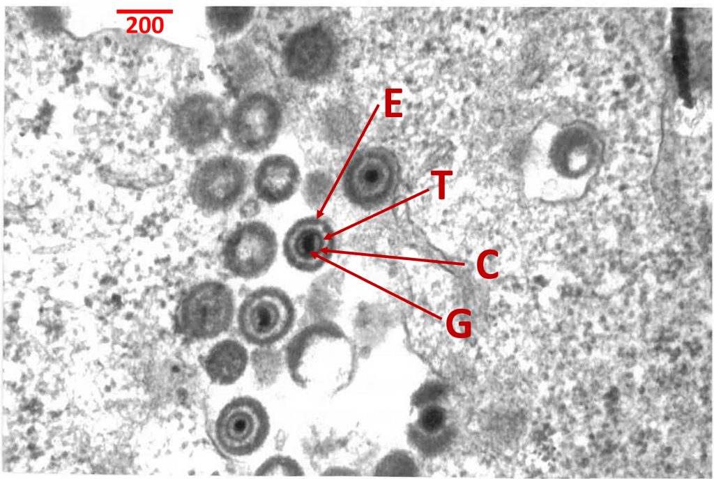 Viral Pathogenic Mechanisms Leading to Stroke After Herpes Zoster ...